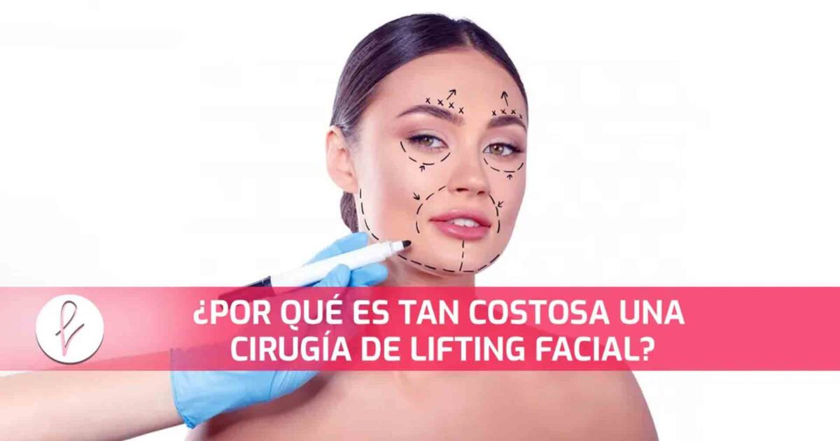 ¿Por Qué es Tan Costosa una Cirugía de Lifting Facial?